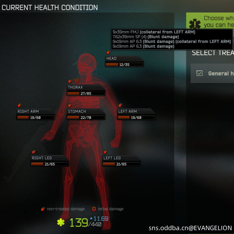 【原创】【AKI-3.8.X】正统的LShZ-2DTM头盔（增强型）-ODDBA社区